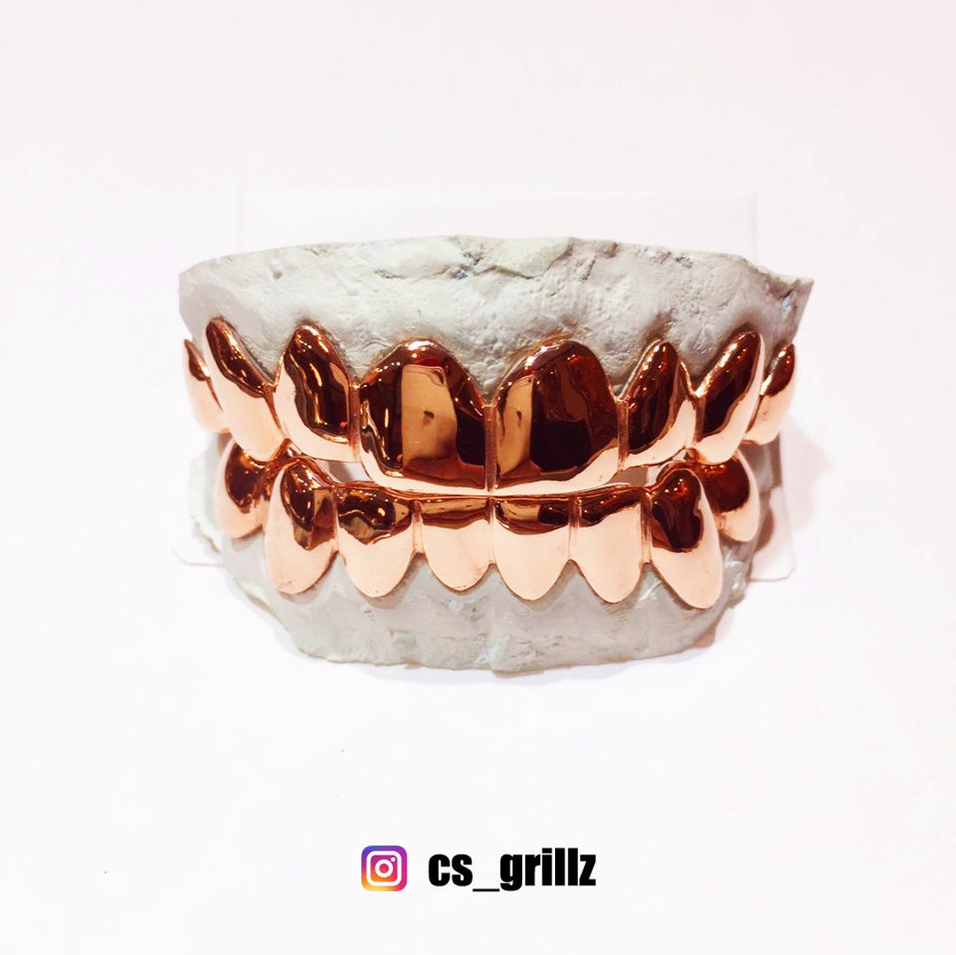 10K Solid Rose Gold Custom Fit REAL Grill Gold Teeth Handmade GRILLZ ...