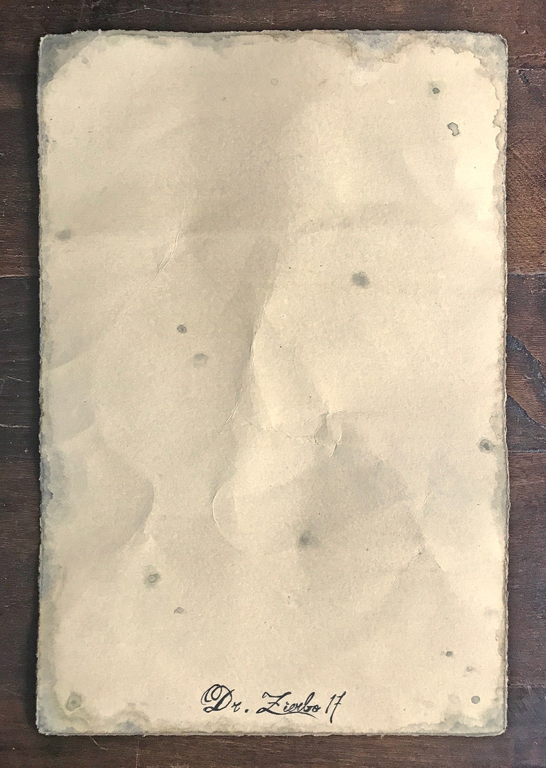 Conjoined twins skeleton Original drawing Medical illustration | Etsy