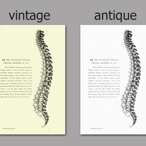 Human Skeleton Bones Print Set of 6 - Human Skull Wall Art - Anatomy ...