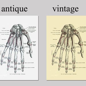 Hand Bone Print Human Anatomy Skeleton Vintage Illustration Print ...