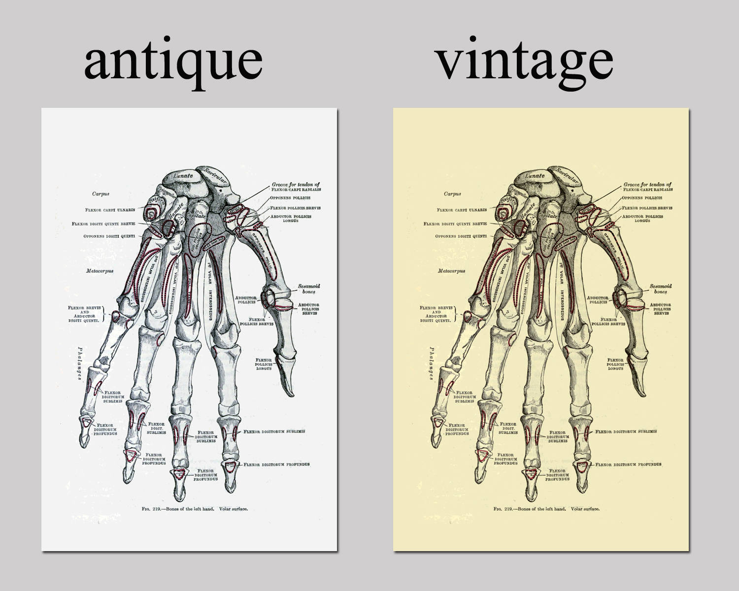 Hand Bone Print Human Anatomy Skeleton Vintage Illustration | Etsy
