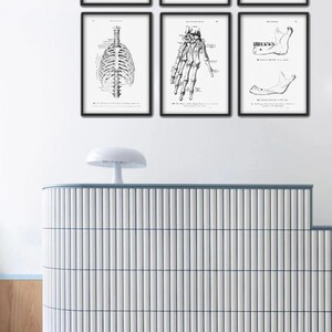 Human Skeleton Bones Print Set of 6 - Human Skull Wall Art - Anatomy ...