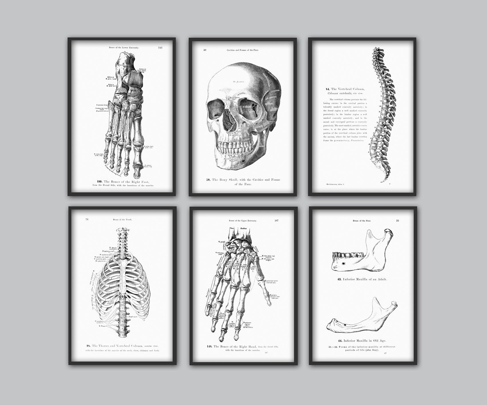 Human Skeleton Bones Print Set of 6 Human Skull Wall Art | Etsy