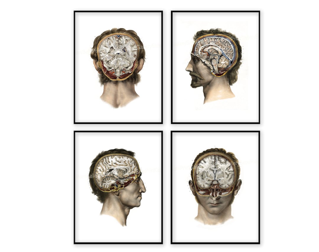 Anatomy Print Antique Brain Cranium Head Skull Hand Colored Engraving ...