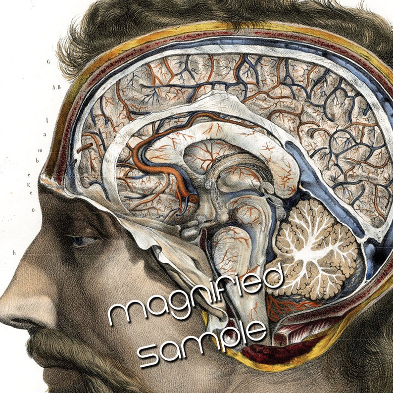 Anatomy Print Antique Brain Cranium Head Skull Hand Colored Engraving ...