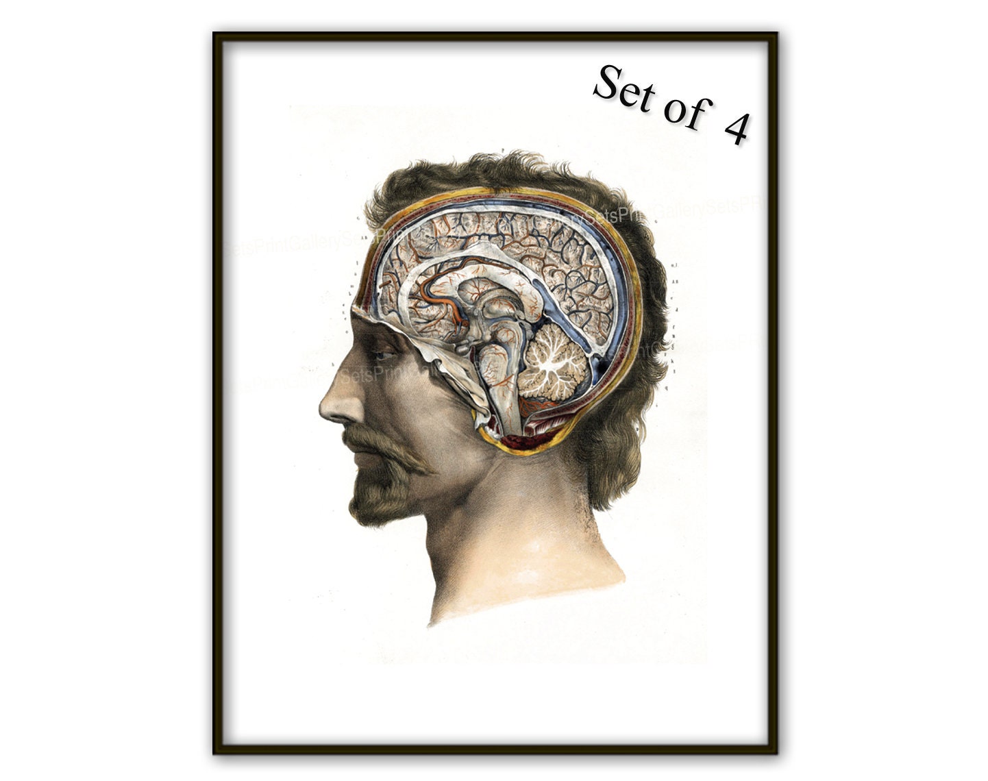 Anatomy Print Antique Brain Cranium Head Skull Hand Colored Engraving ...