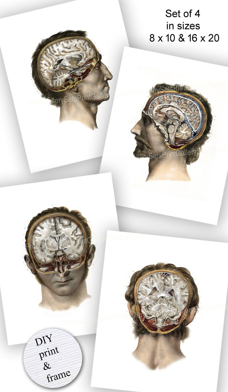 Anatomy Print Antique Brain Cranium Head Skull Hand Colored Engraving ...