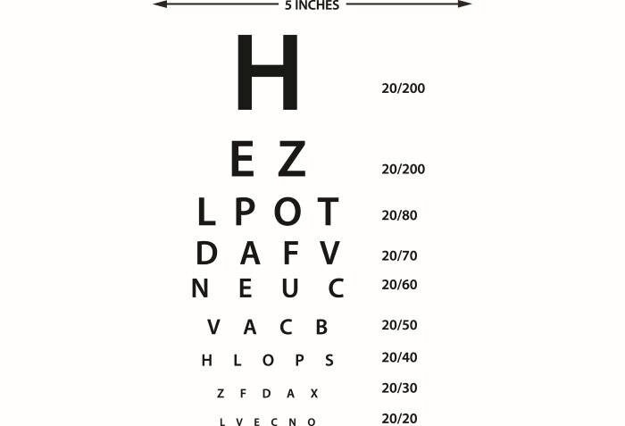 Opticians Eye Chart Broken Spectacles On Opticians Snellen Eye Test ...