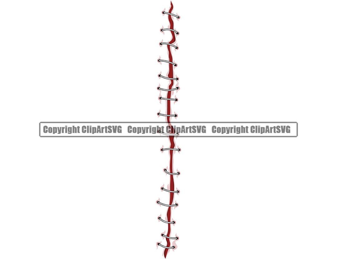 Blood Stitches Staples Drip Scab Slice Cut Drop Pain Medical Stain ...