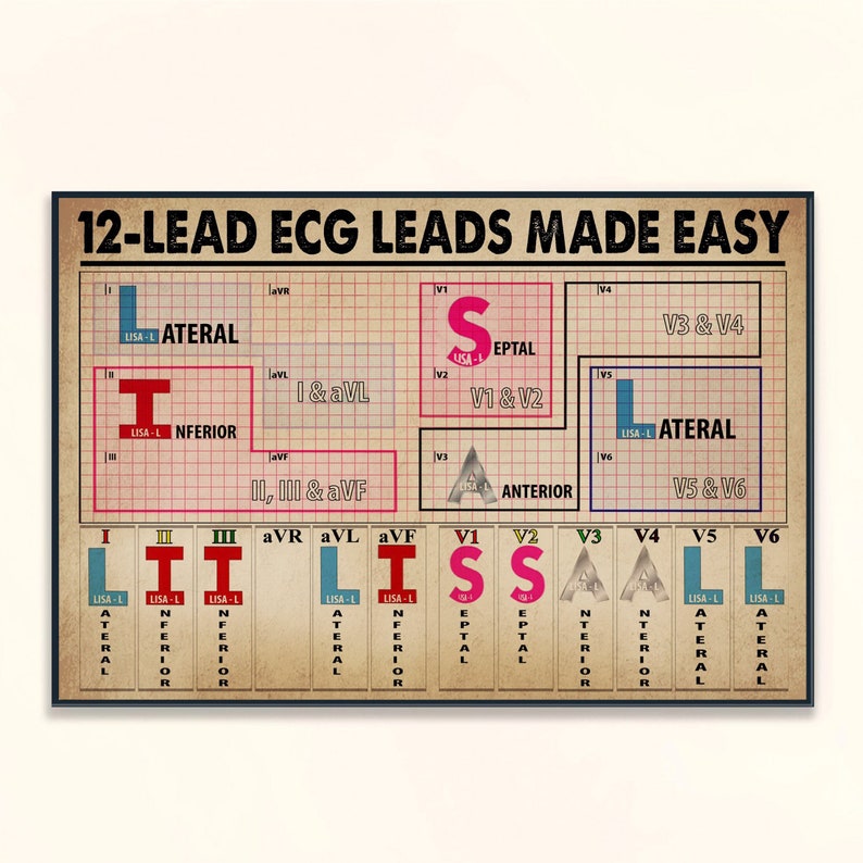 12-lead Ecg Leads Made Easy Wall Decor Posters Cardiologist Guide ...