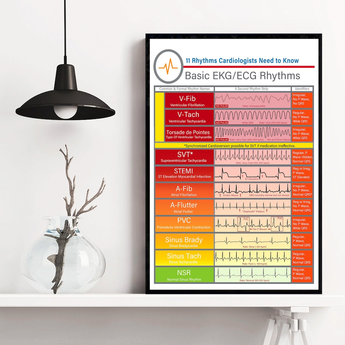 Basic EKG ECG Rhythms Poster – Medical Knowledge Wall Art – Nursing ...