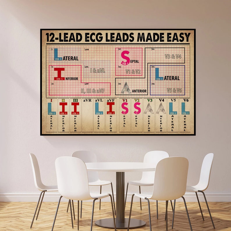 12-lead ECG Poster Wall Art, Cardiologist Guide Print, Heart Rhythm ...