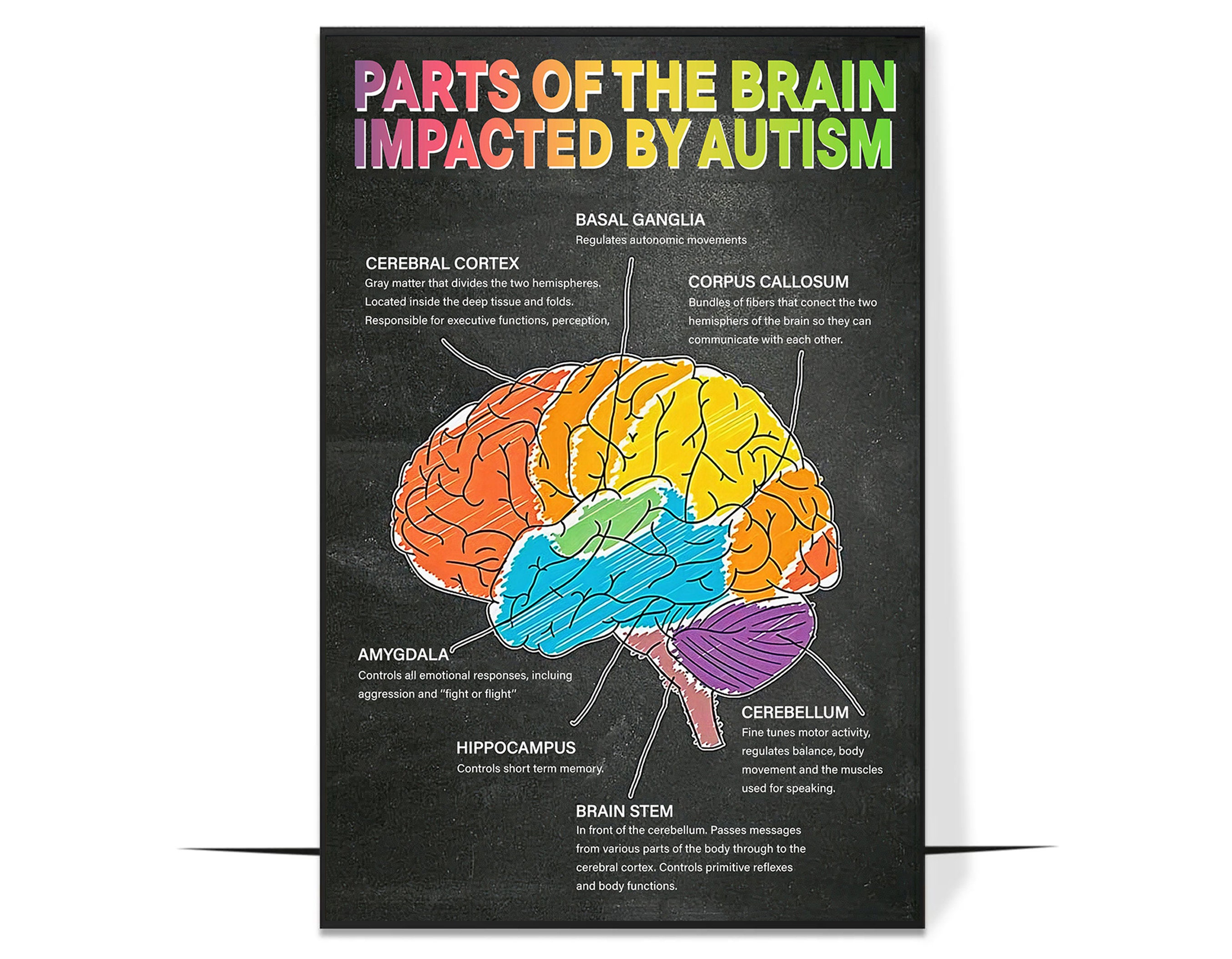Autism Brain Affected