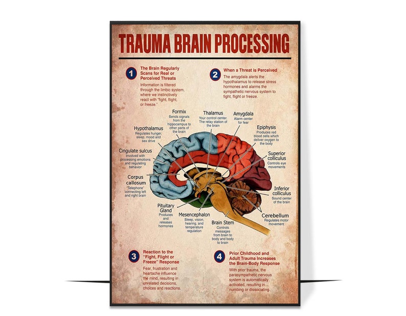 Trauma Brain Processing Processing Poster Therapist - Etsy