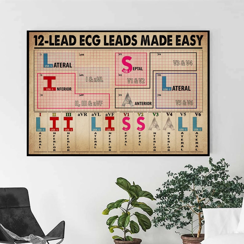 12-lead Ecg Leads Made Easy Wall Decor Posters Cardiologist Guide ...
