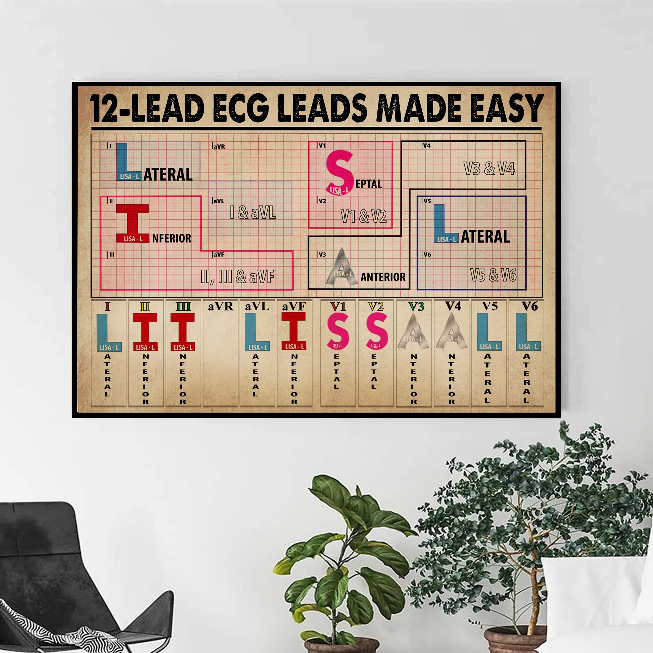 12-lead Ecg Leads Made Easy Wall Decor Posters Cardiologist - Etsy