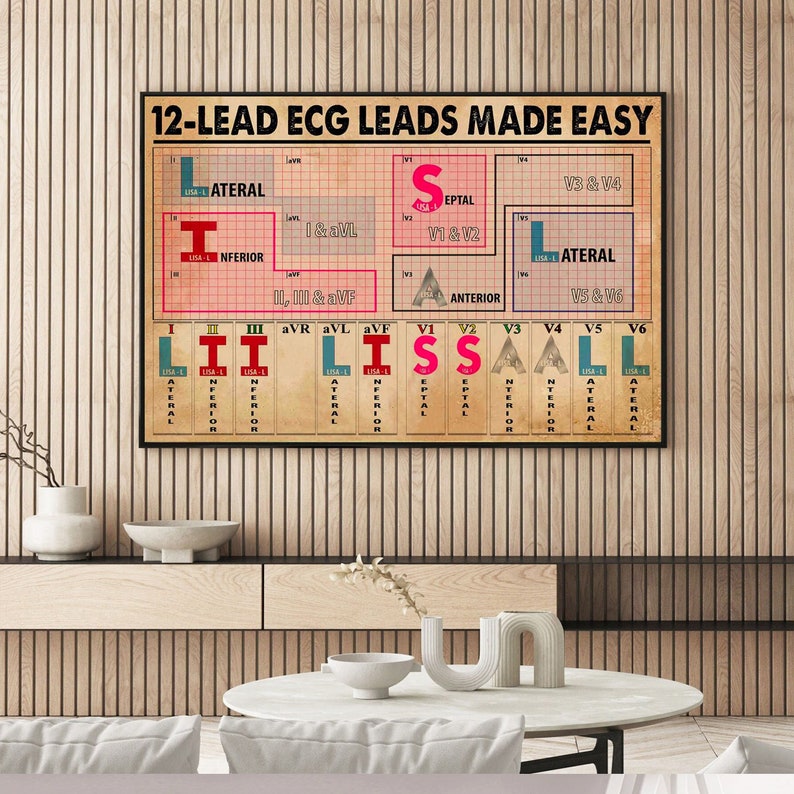 12-lead Ecg Leads Made Easy Wall Decor Posters Cardiologist Guide ...