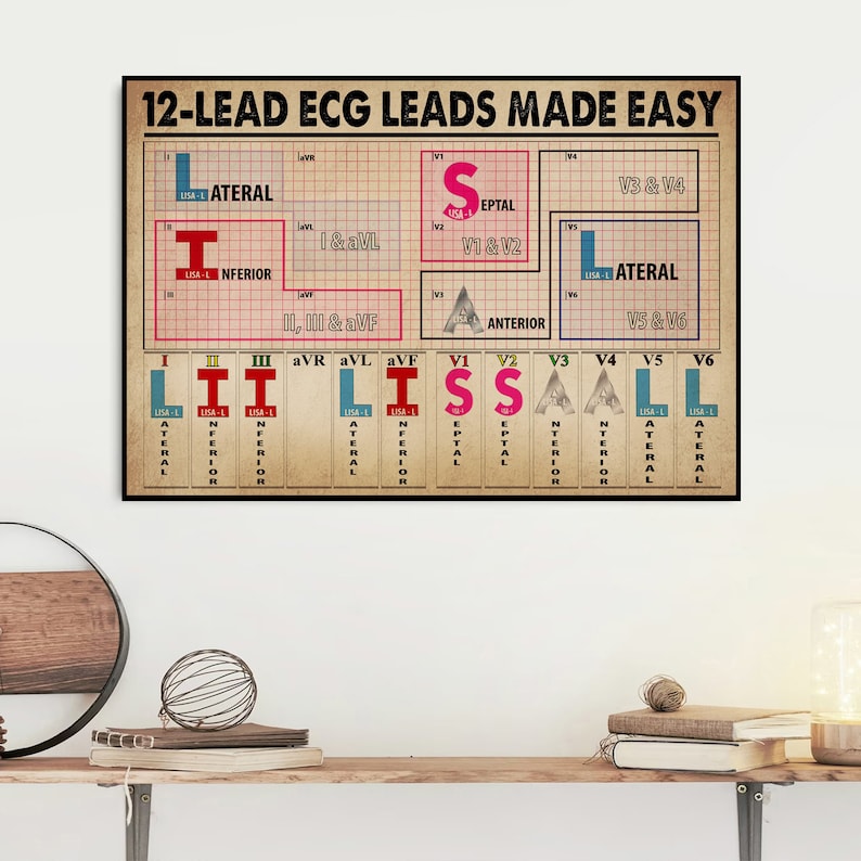 12-lead ECG Poster Wall Art, Cardiologist Guide Print, Heart Rhythm ...