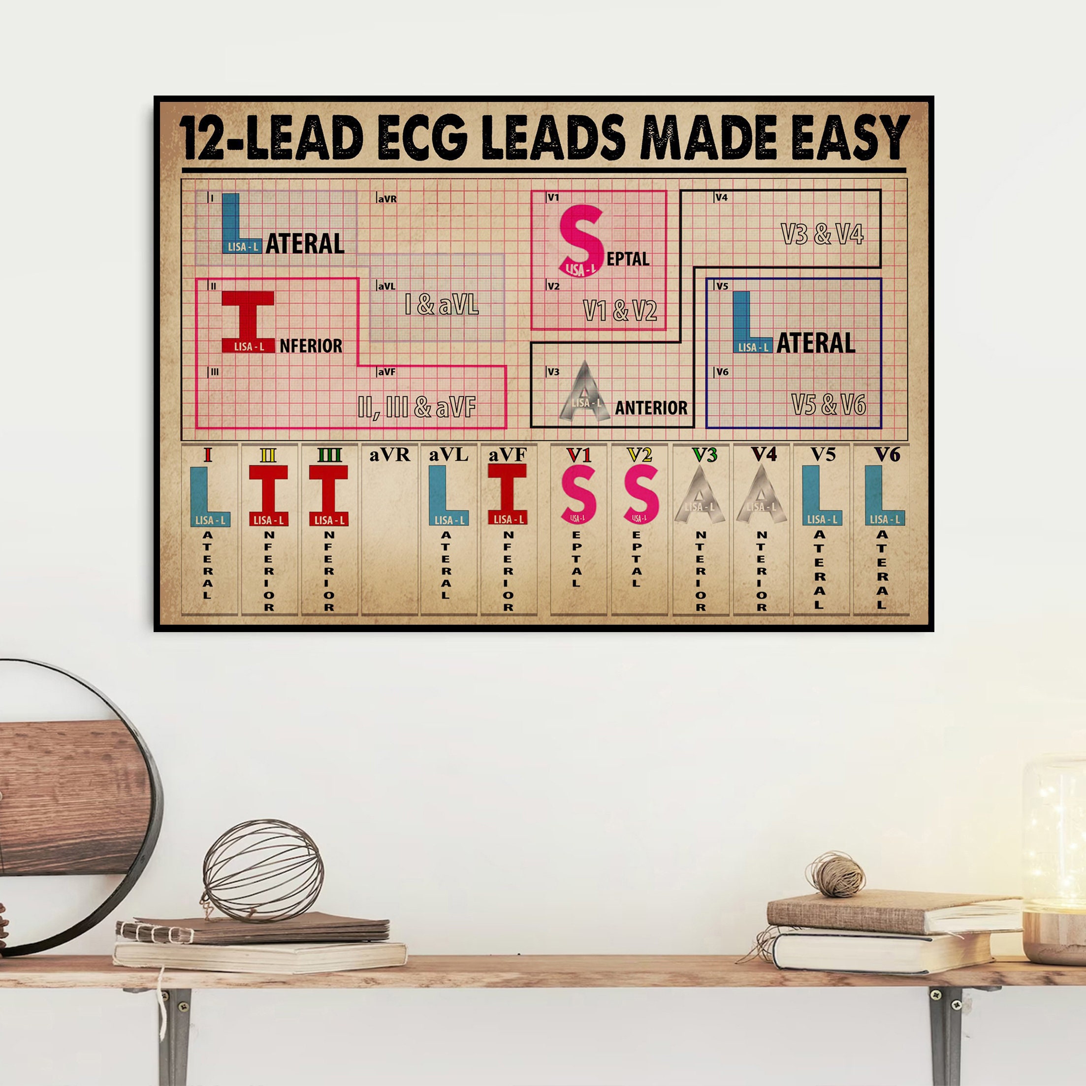 12-lead Ecg Leads Made Easy Wall Decor Posters Cardiologist Guide ...