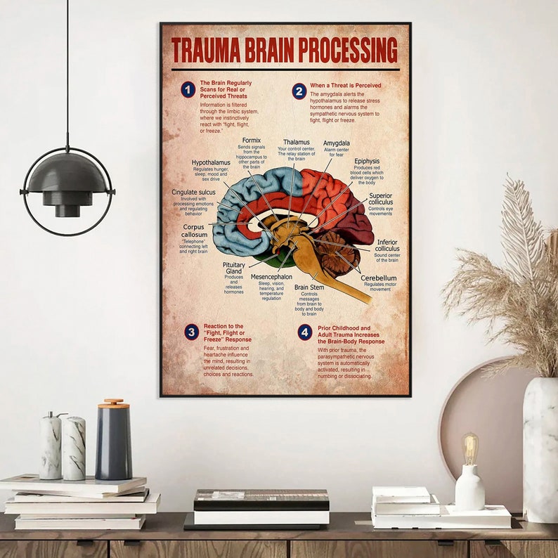 Trauma Brain Processing Processing Poster Therapist - Etsy