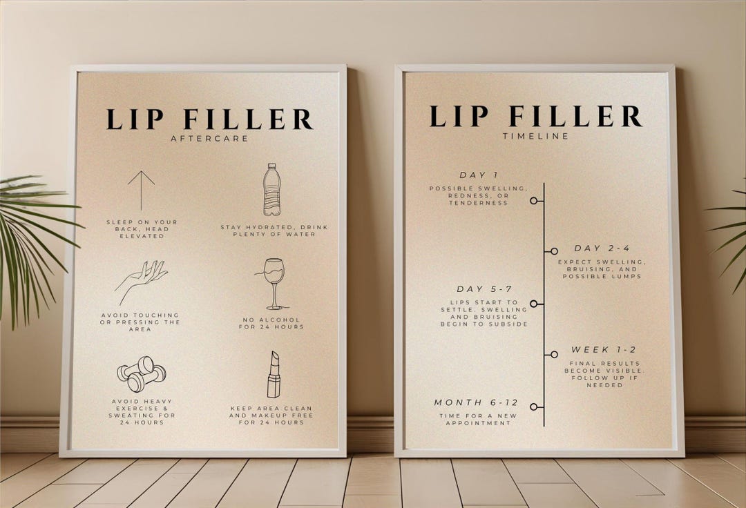 Lip Filler Aftercare & Timeline Posters: Printable Med Spa and Injector ...