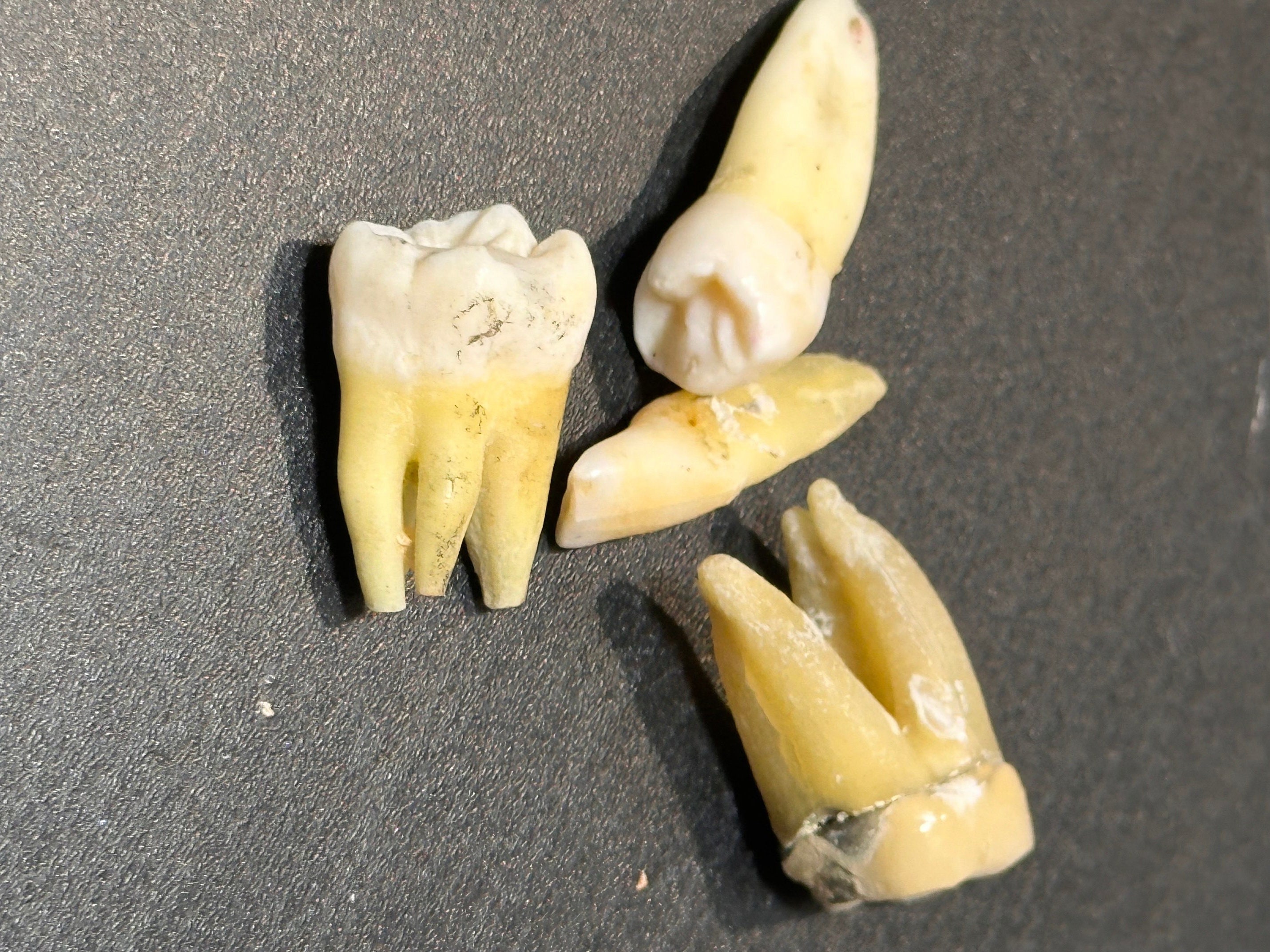 4 Human Teeth in Glass Bottle Craft Supply - Etsy