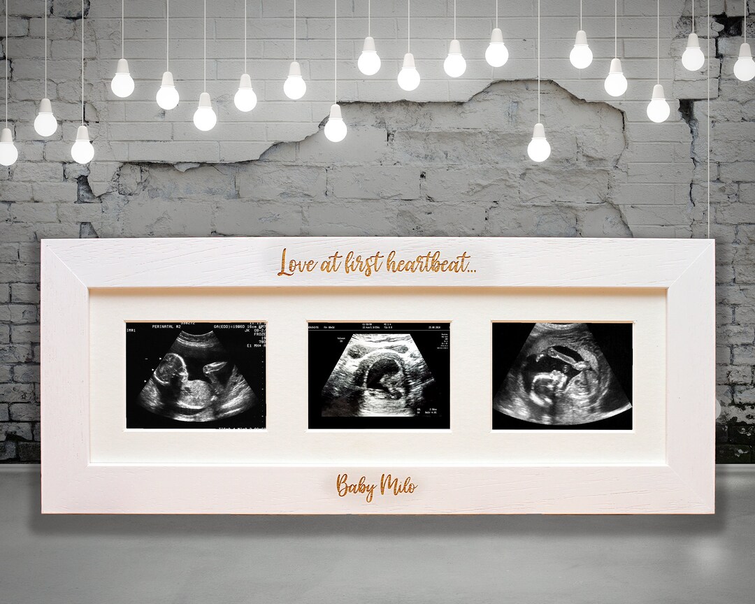 Baby Scan Picture Frame Baby Shower Gift New Dad Gift BF3 - Etsy