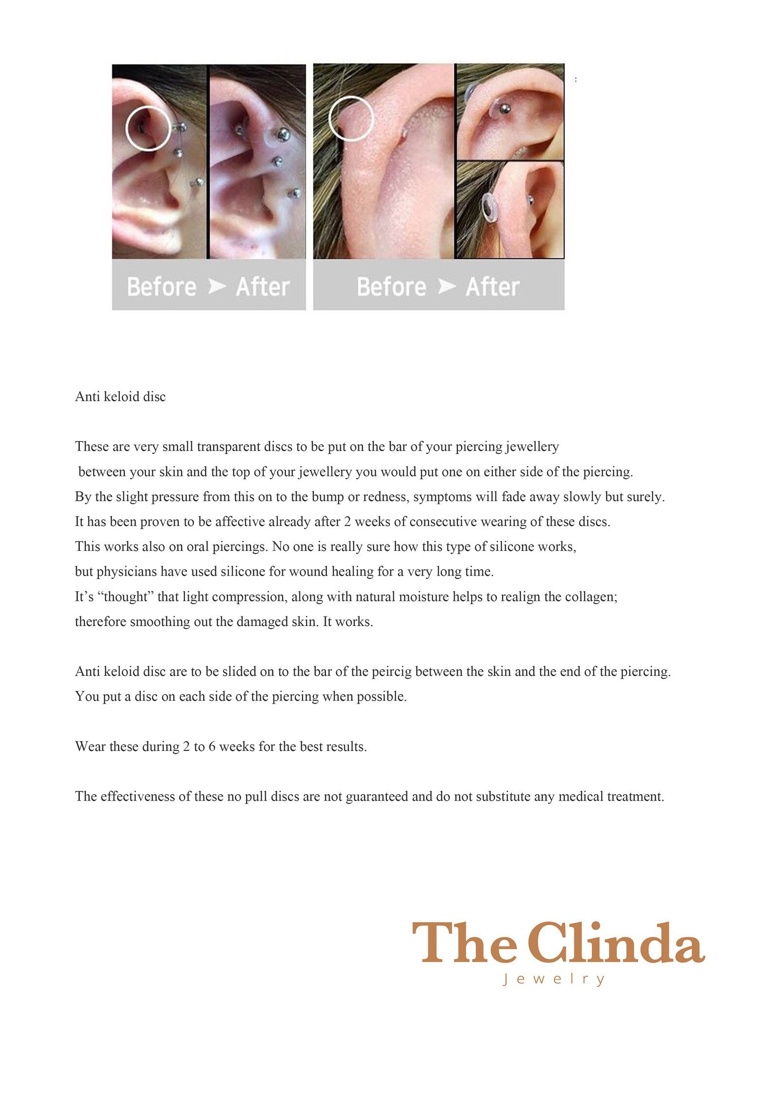 Silicone Piercing Healing Discs Flexible Ear Stud Lip Ring | Etsy