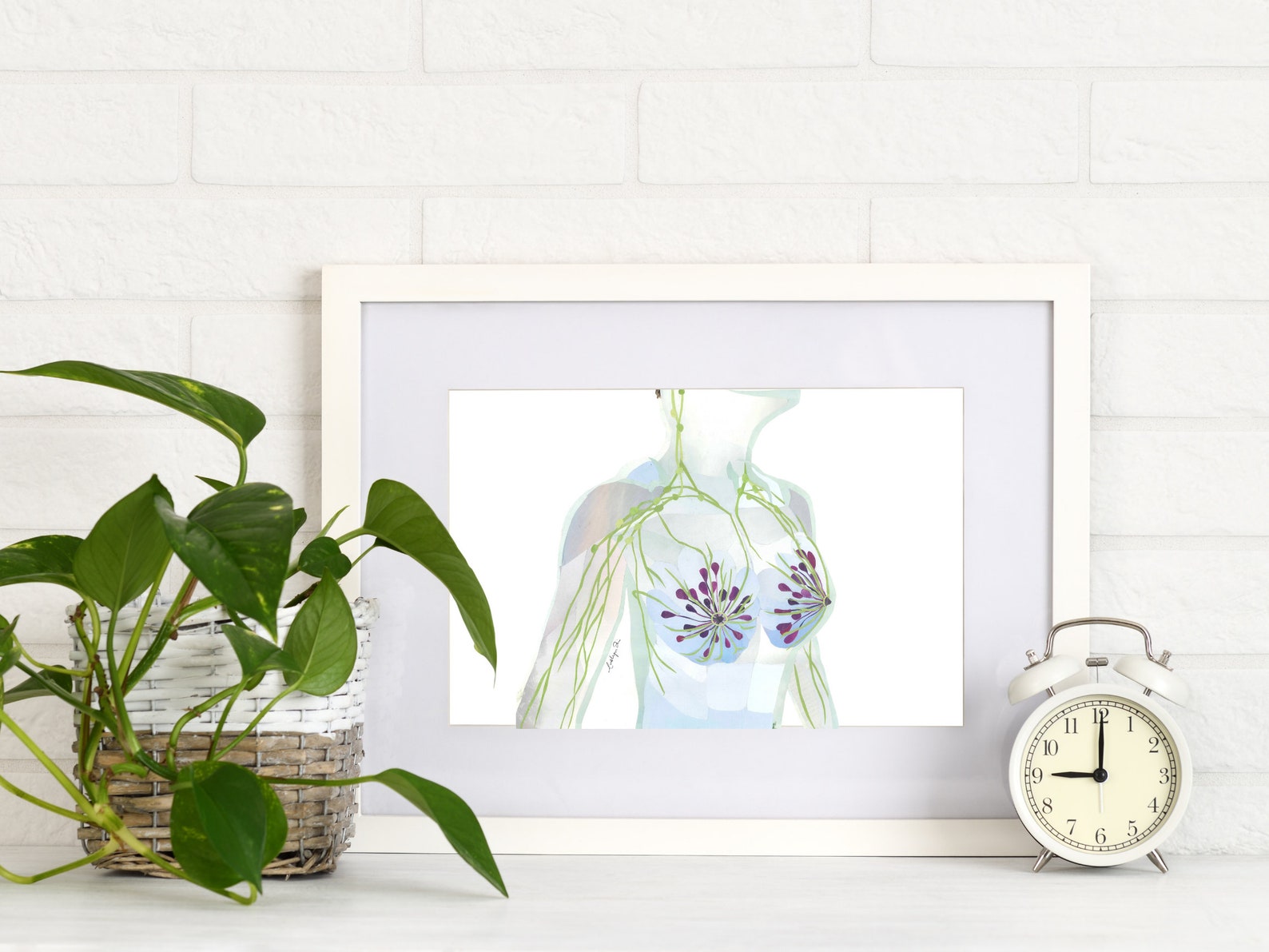 Lymphatic System Lymphedema Collage Art Digital Download - Etsy