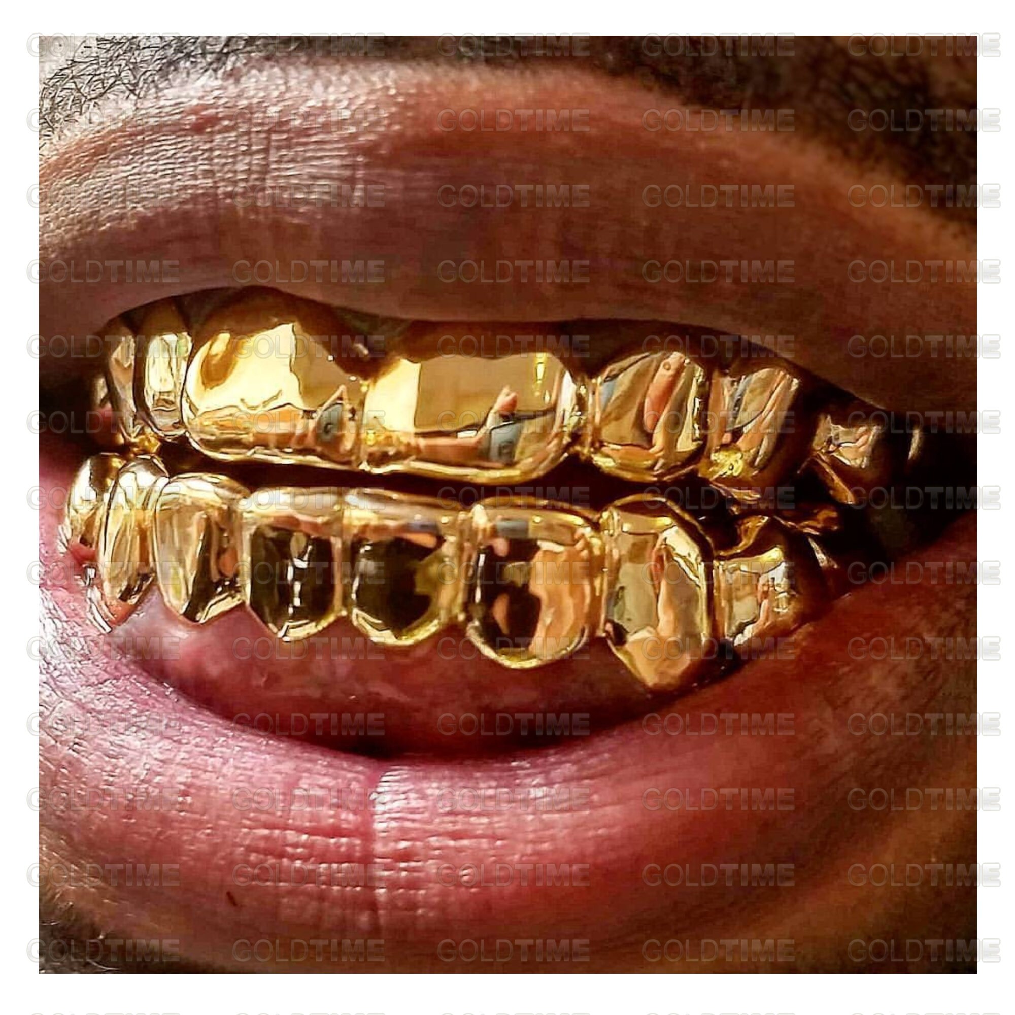 Custom Classic Solid Genuine Gold Grillz Top/bottom/set Dental - Etsy