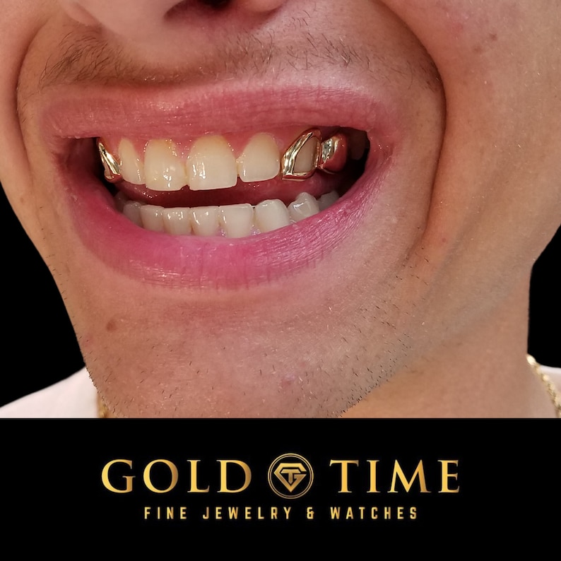 Custom 4-piece Gold Grillz Set – Open Face & Solid Caps, Handmade ...