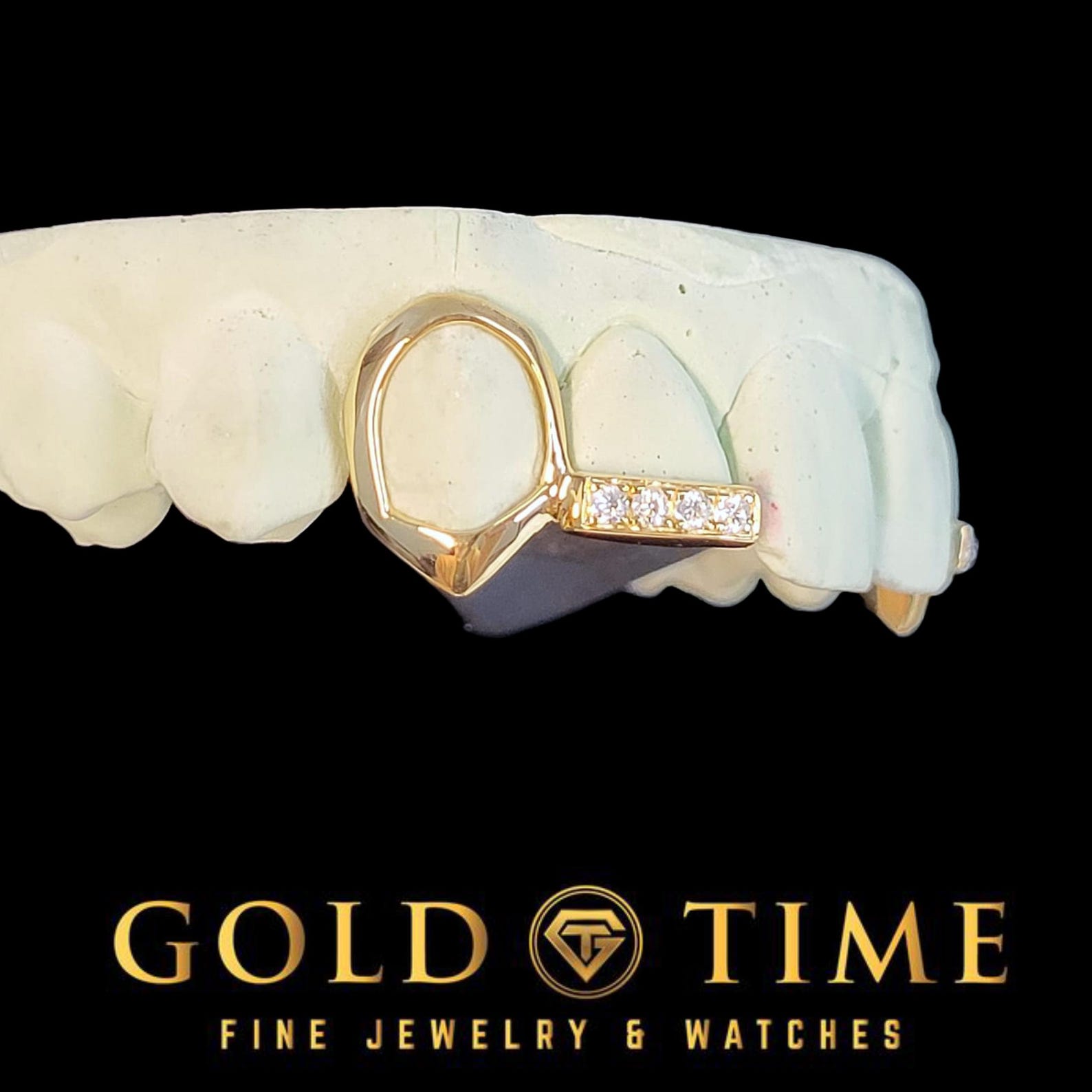 Custom 4-piece Open Face Fangs With Custom Cut Out and Iced Moissanite ...