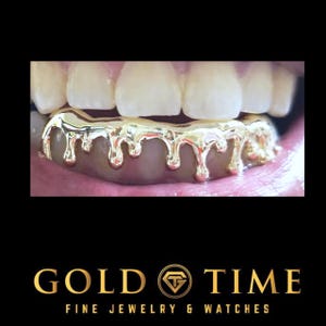 8-piece Custom Drip Grillz – Melting Drip Design – Silver or Gold ...