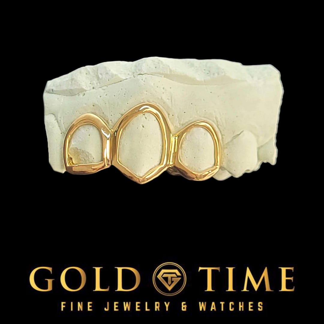 Custom 3-piece Open Face Grillz – Handmade Silver, 10k, 14k, 18k Gold ...