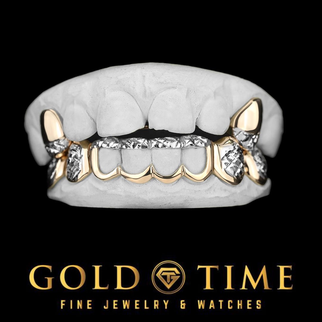 Custom 10 Piece Grillz Set With Trillion Tips and Open Windows in Two ...