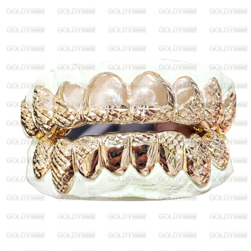 Custom Classic Solid Genuine Gold Grillz Top/bottom/set Dental - Etsy