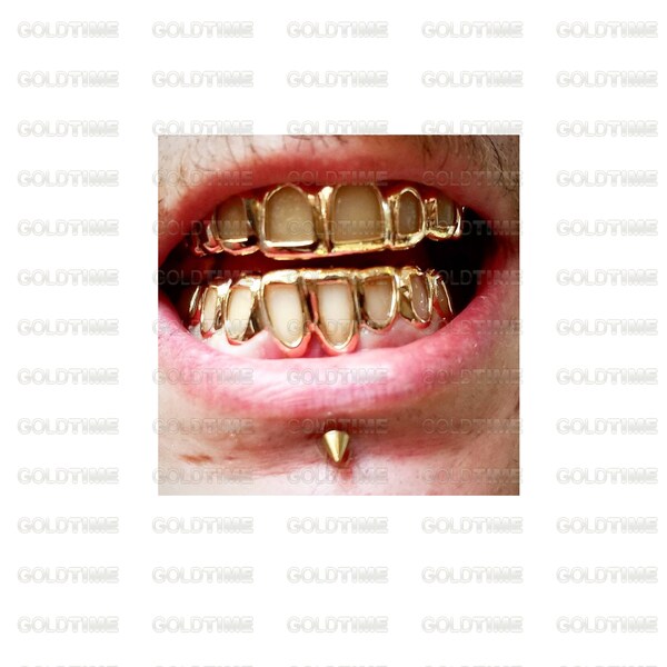 Gold Teeth Caps - Etsy