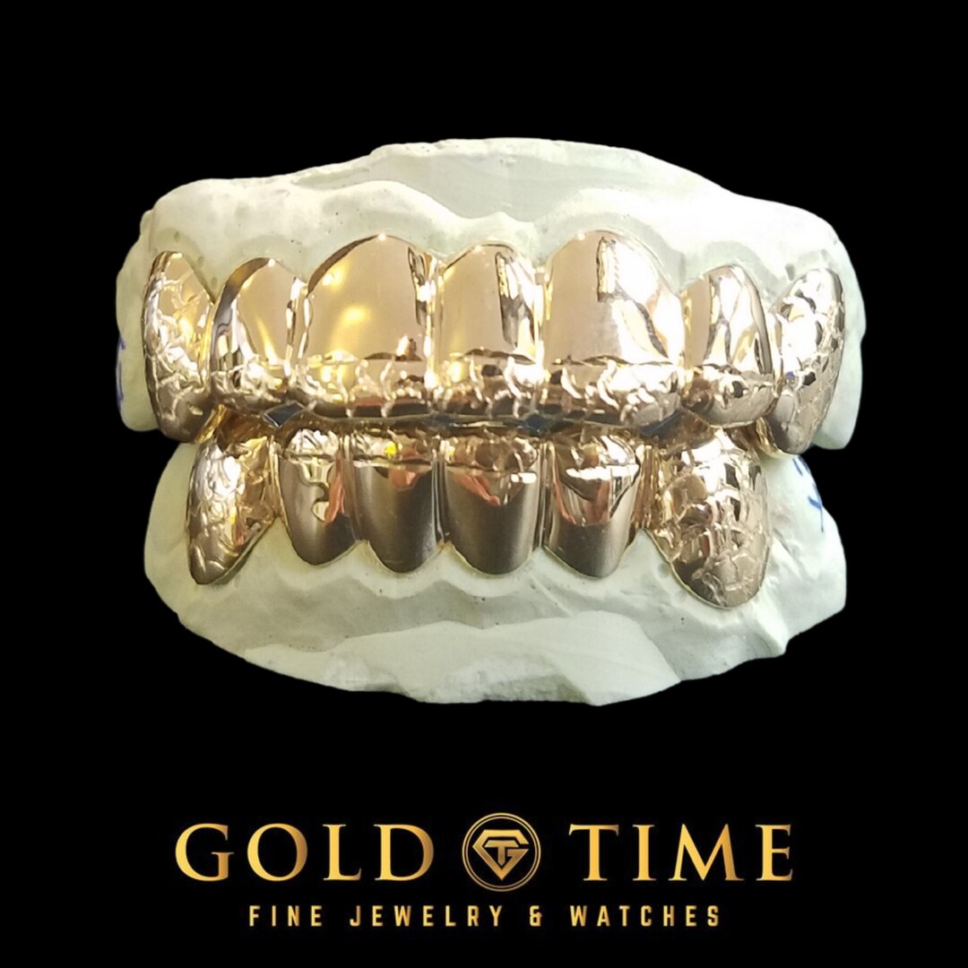 Custom Full 12 Piece Grillz Set With Nugget Front Tips & Canines ...