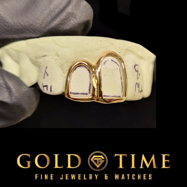 Custom Open Face 2 Piece Grillz – Handmade Gold or Silver Double Teeth ...