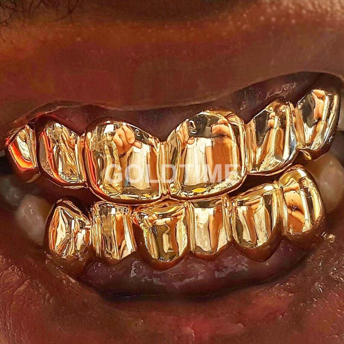 Custom Classic Solid Genuine Gold Grillz Top/bottom/set Dental Gold ...