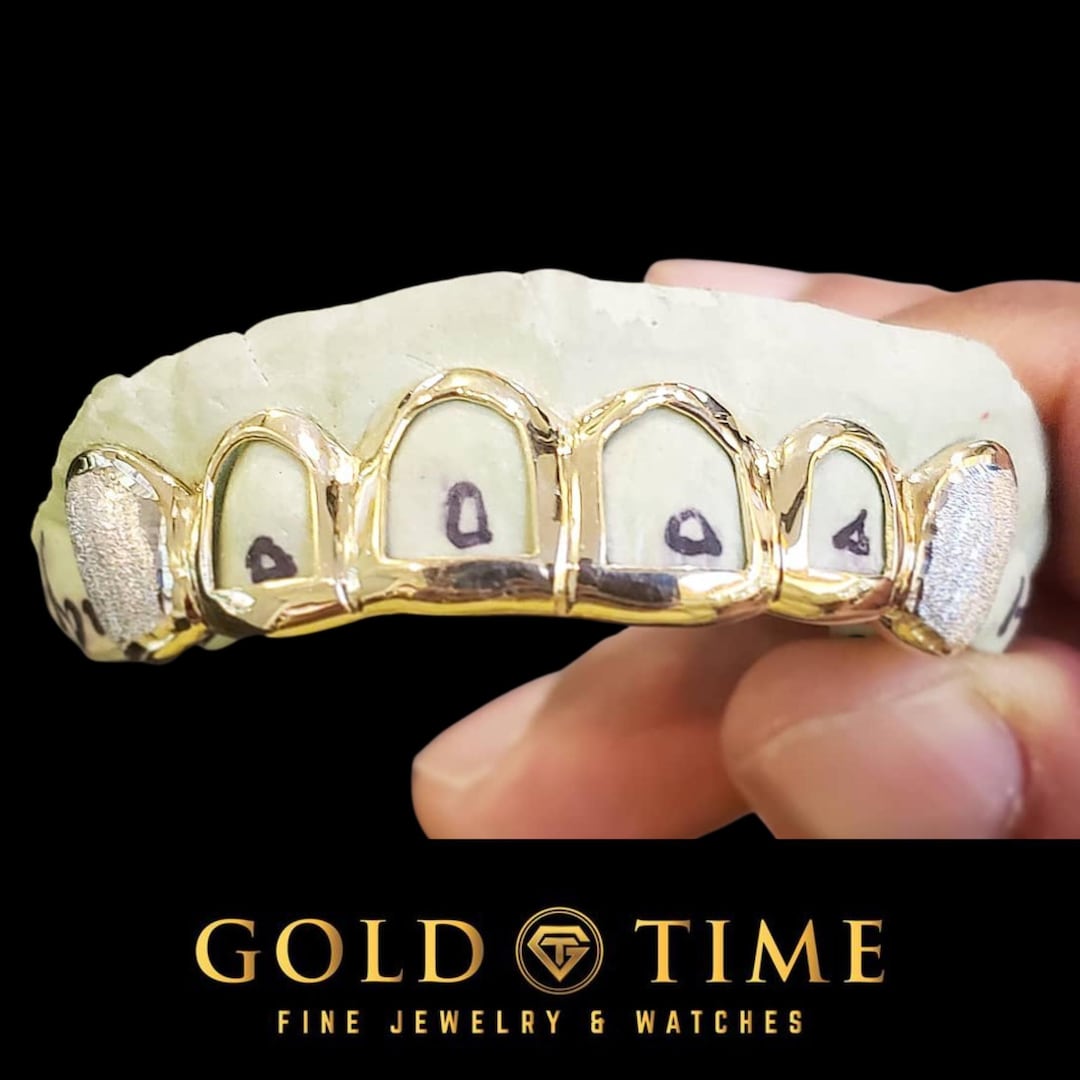 Custom Diamond Dust Canines Grillz – 6 Piece Open Face Gold Teeth ...