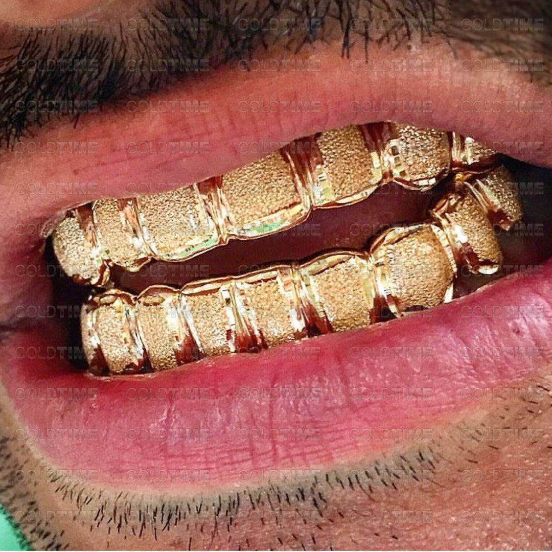Custom Box Diamond-dust Grillz: 6-piece Silver, 10k, 14k Gold ...
