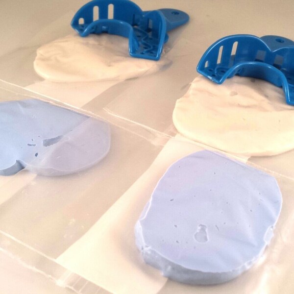 Dental Impression Kit - Etsy