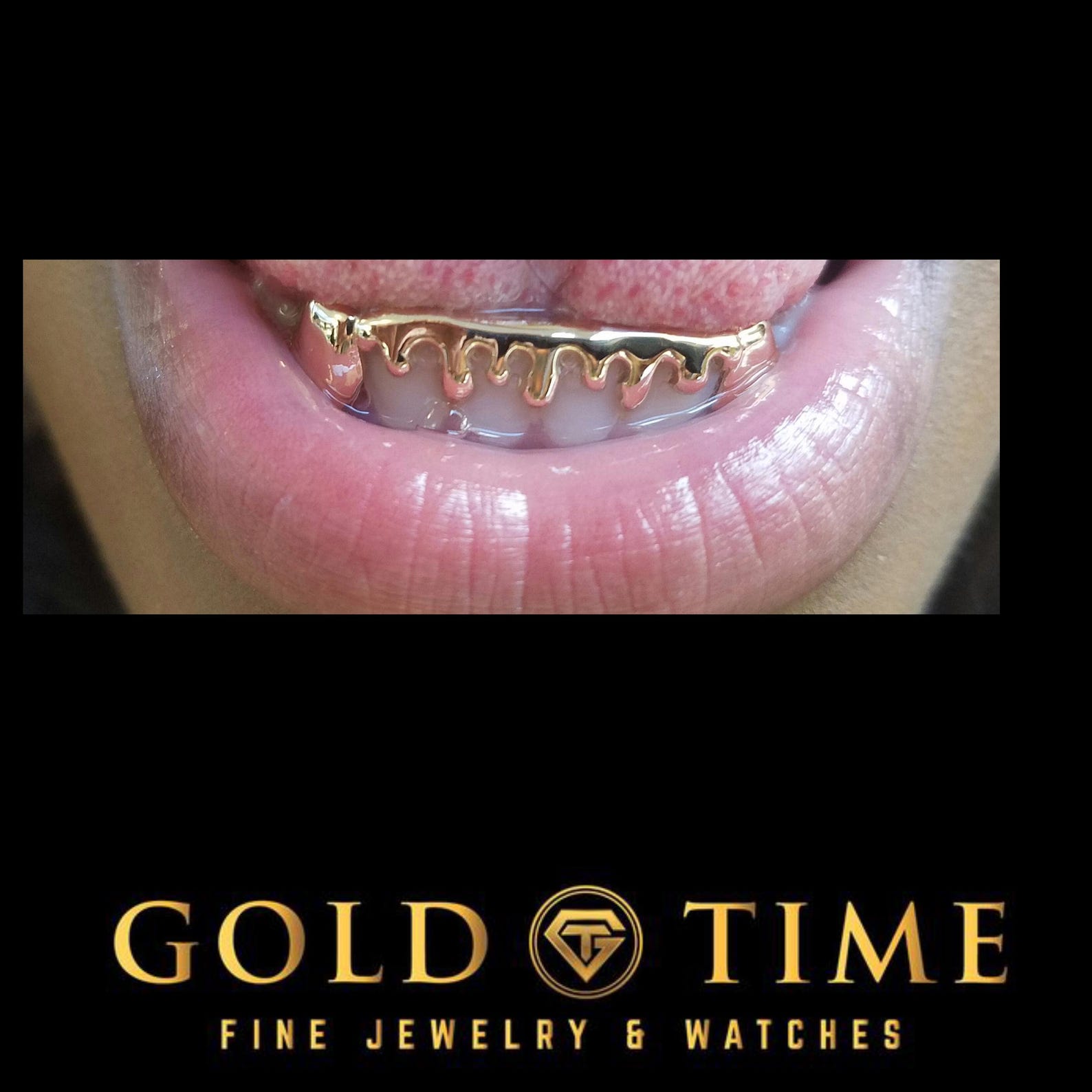 Custom 8 Piece Drip Grillz: Handmade Silver or Gold Tooth Caps ...