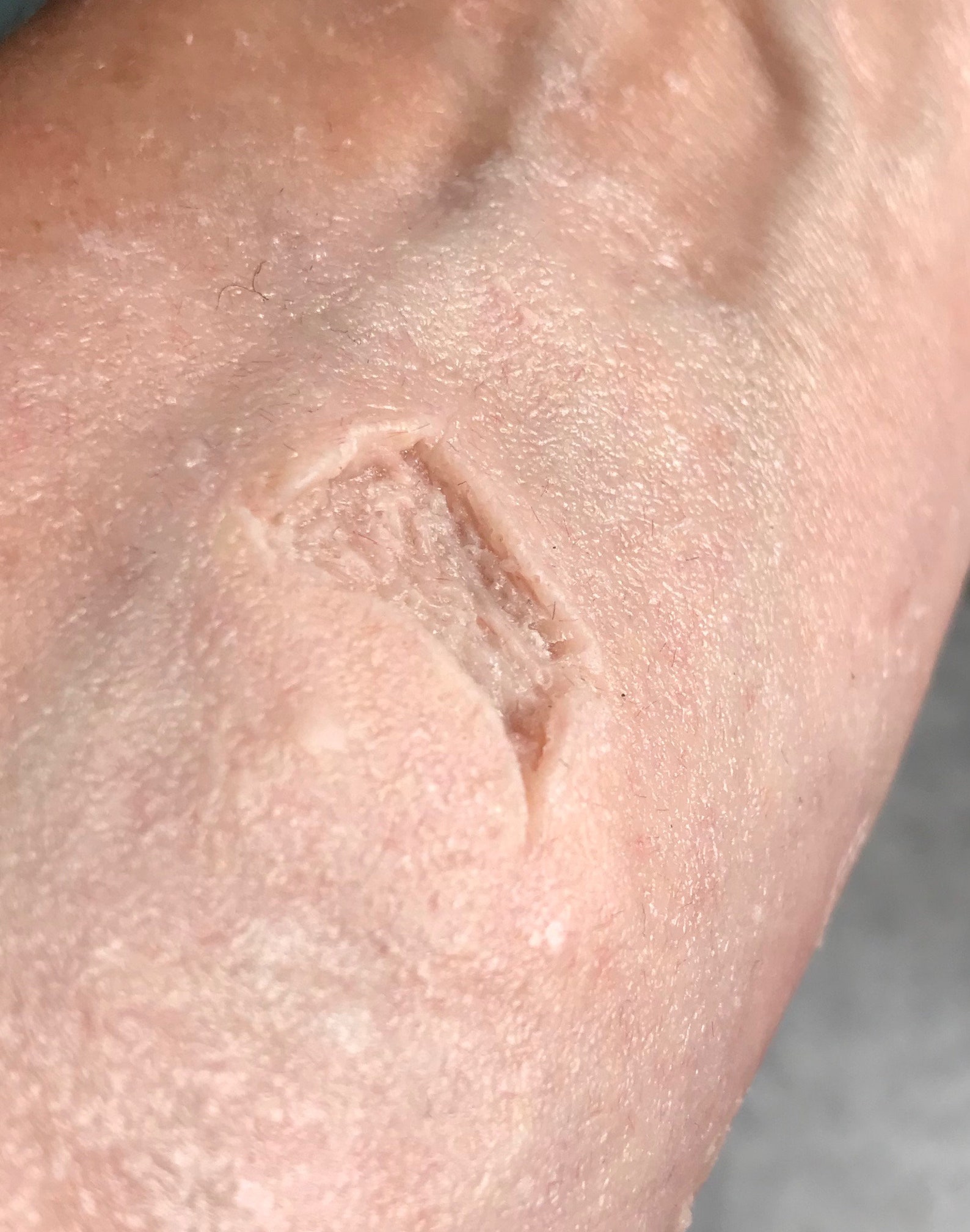Encapsulated SFX Silicone damaged skin prosthetic | Etsy