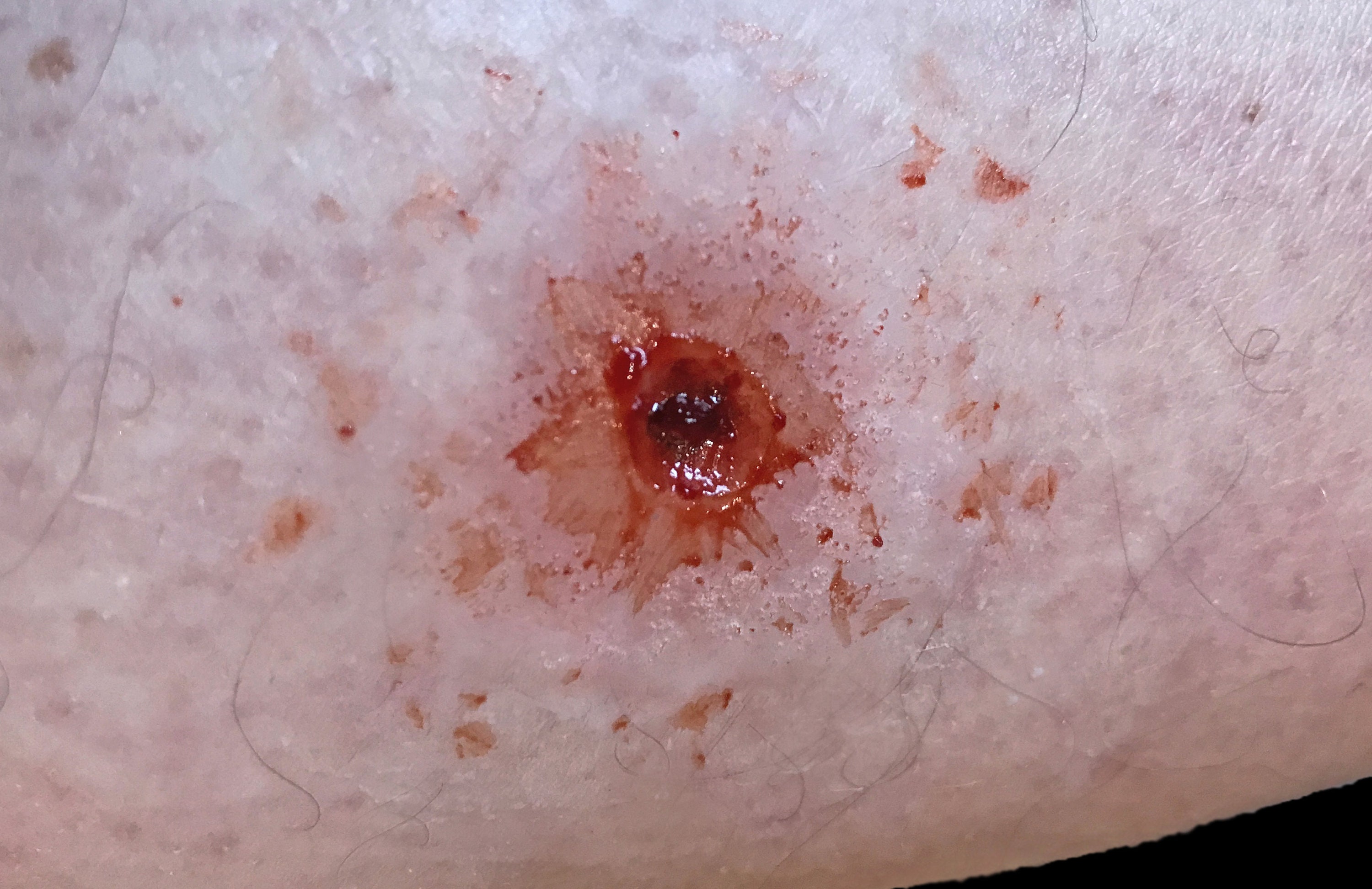 SFX Prosthetic Gelatine Bullet Wounds. | Etsy