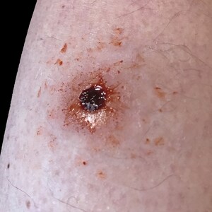 SFX Prosthetic Gelatine Bullet Wounds. - Etsy