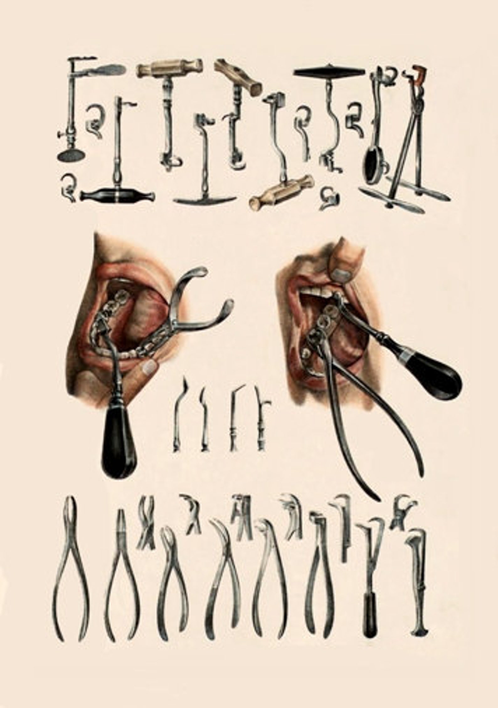 Antique Medical Illustration Of Examples Of Dental Tooth | Etsy
