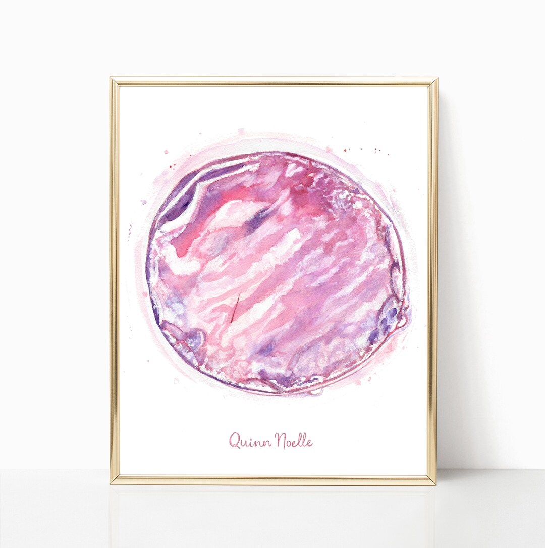 Embryo Art - Custom Nursery Art - Embaby - IVF Gift - IVF Pregnancy ...