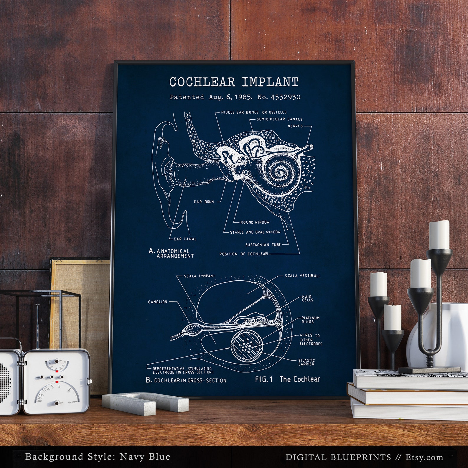 Cochlear Implant Patent Print, Anatomy Wall Art, Audiologist Gift ...